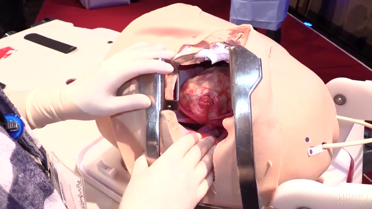 EEMCrit 2018 017 Live Thorocotomy Demonstration