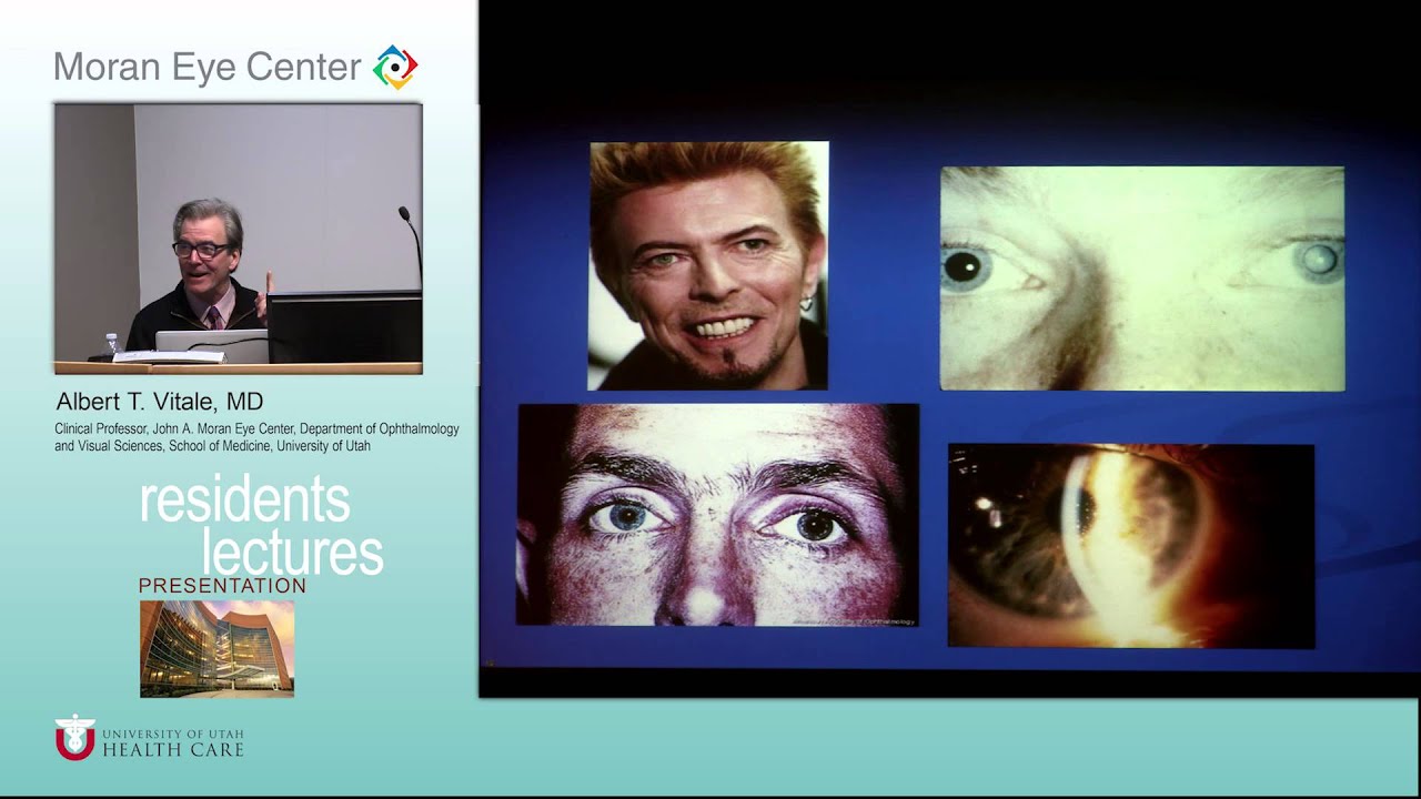 OKAP Review: Uveitis [ARCHIVE]