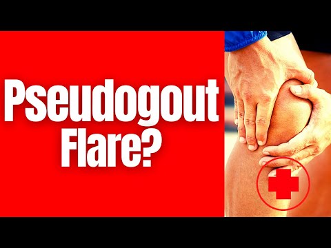Pseudogout Flare✔️ www.EaseKneePain.com #pseudogout #flare #shorts