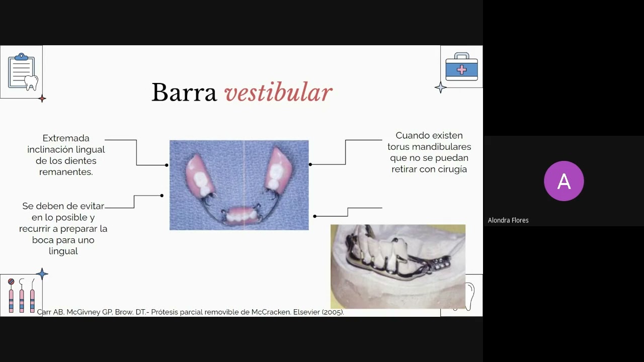 Conector mayor y menor, PPR