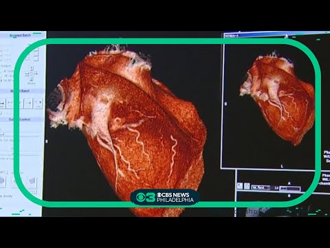 Bronny James cardiac arrest: Why it is common in young athletes