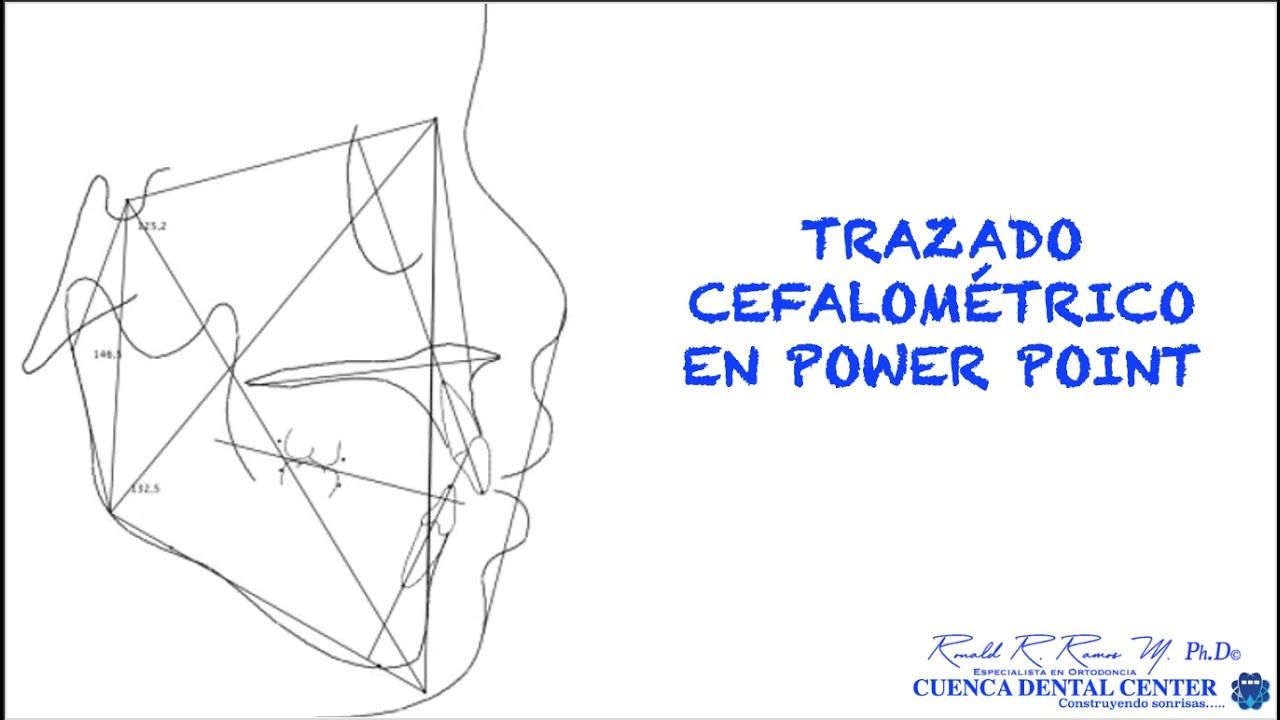 TRAZADO CEFALOMÉTRICO CON POWER POINT