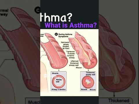 What is Asthma How does it affect the lungs Link to video in description!