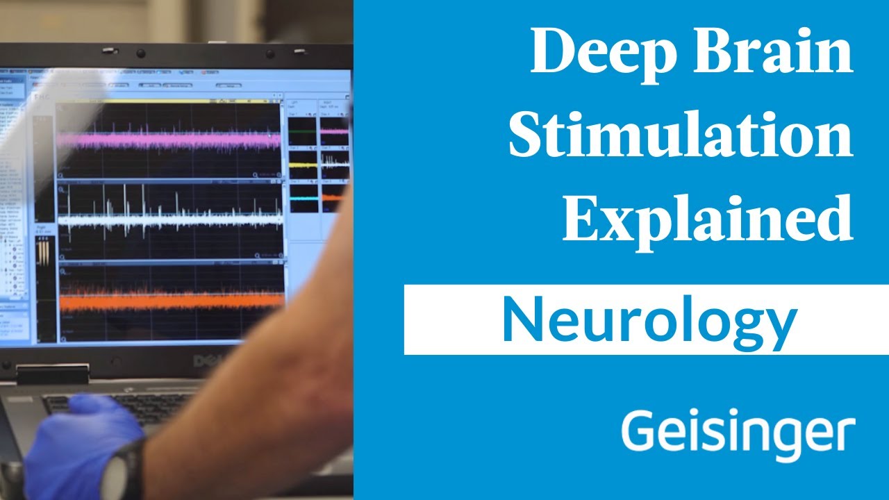 How deep brain stimulation can improve life with movement disorders – Geisinger
