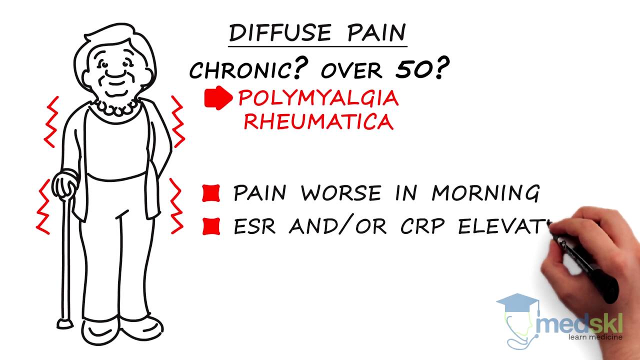 Rheumatology – Non-Articular Musculoskeletal Pain: By Alexa Smith M.D.