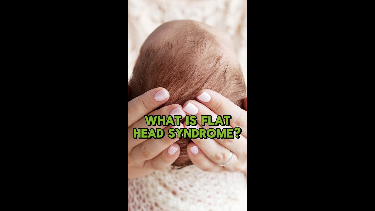 What Is Flat Head Syndrome? Let's talk about Plagiocephaly with Dr. Jess
