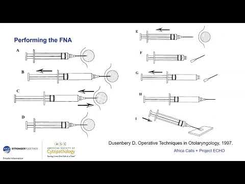 ASCP Cytology Calls Intro to Interventional Cytology