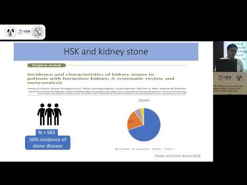 "Horseshoe Kidney: Understanding the Rare Connection That Shapes Lives!"