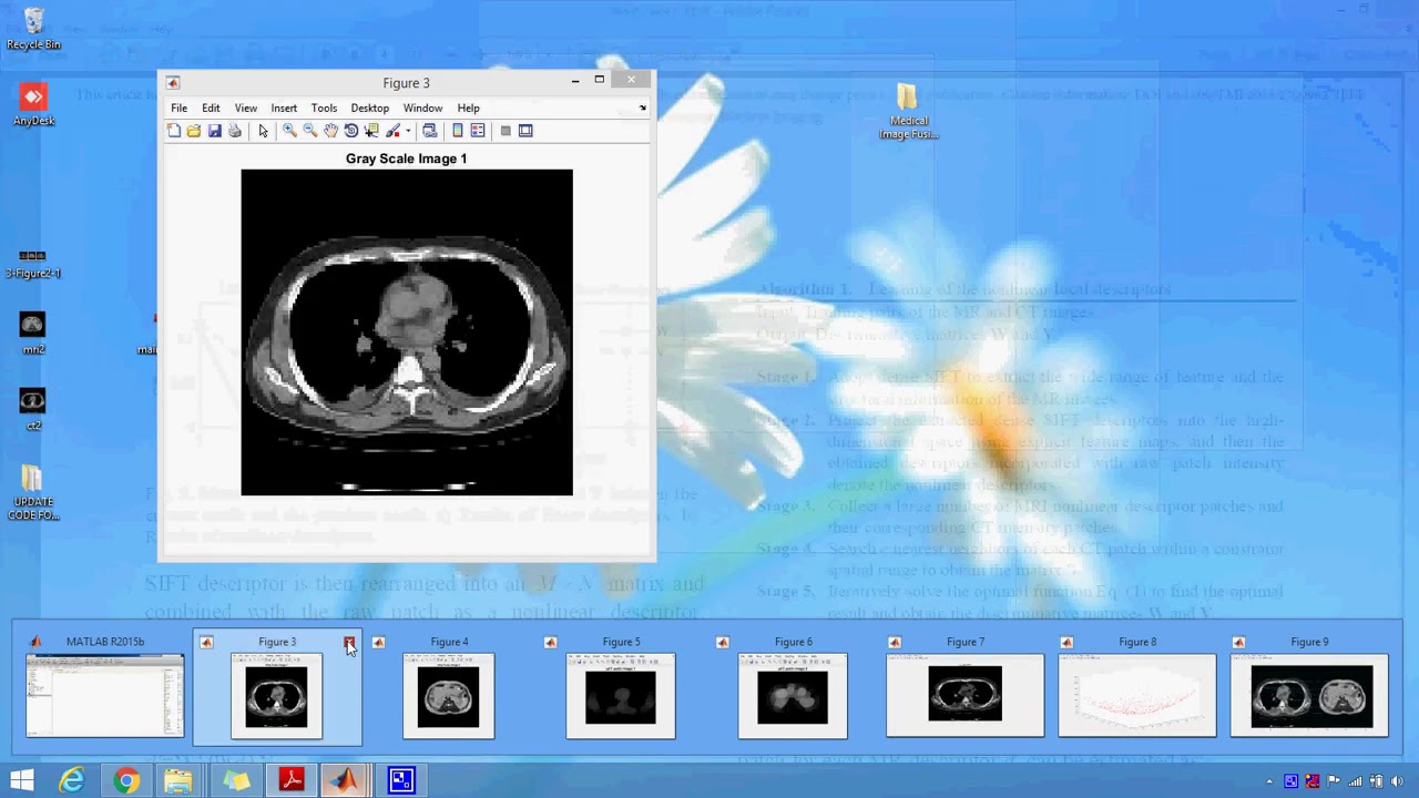 Predicting CT image from MRI Data through Feature Matching with ...