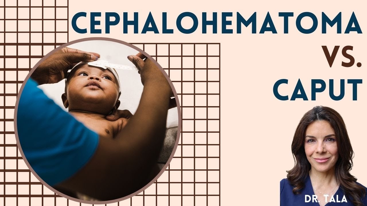 Caput Succedaneum vs Cephalohematoma - NICU Nuggets - Tala Talks NICU