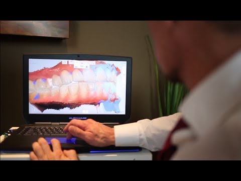 Creating Perfect Teeth with the Latest Dental Technologies