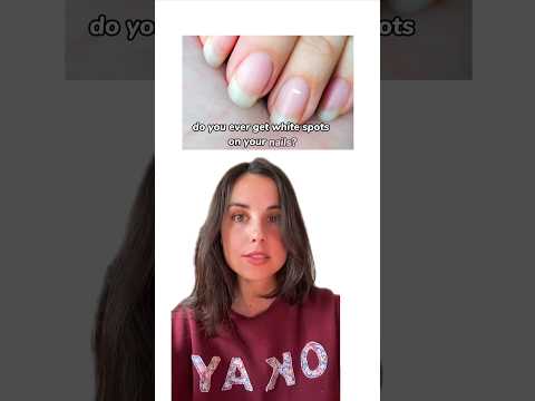 Causes of white spots on nails