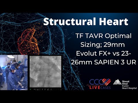 TF TAVR Optimal Sizing; 29mm Evolut FX+vs 23-26mm SAPIEN 3 UR