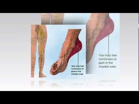 pain in top of foot| 1-623-295-1511 | podiatrist| bunion surgery| side of foot pain|85308