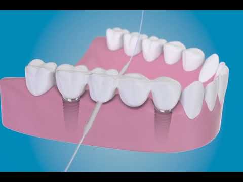 Hilo Dental Superfloss Oral-b | Mercado Libre