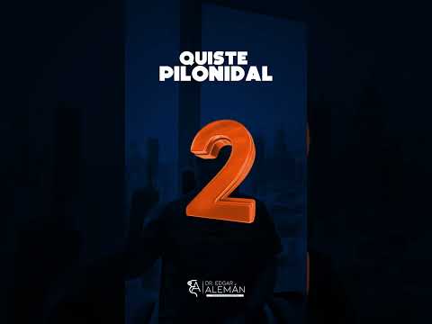 Conoce 3 curiosidades del quiste pilonidal #coloproctología #quistepilonidal #proctologos