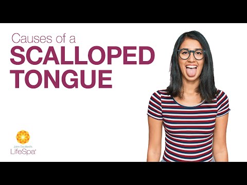 Causes of a Scalloped Tongue | Dr. John Douillard's LifeSpa