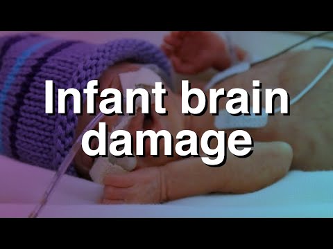 Infant brain damage #braindamage
