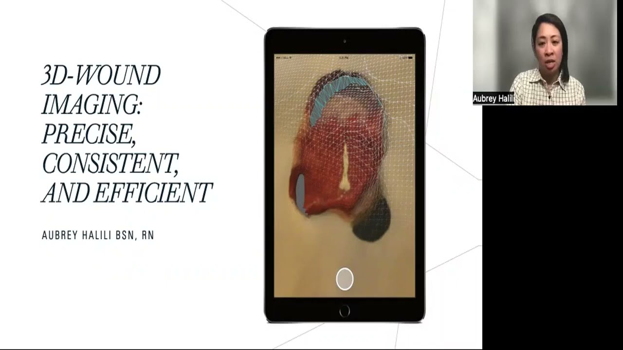 3D Wound Technology Precise, Consistent, and Efficient
