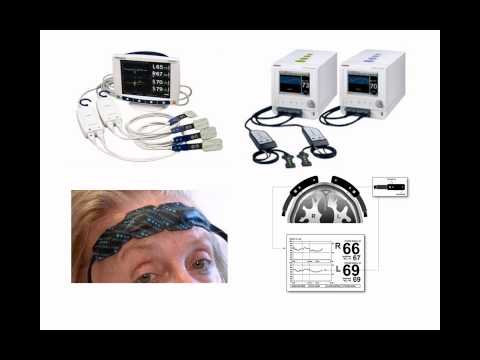 cerebral oximetry