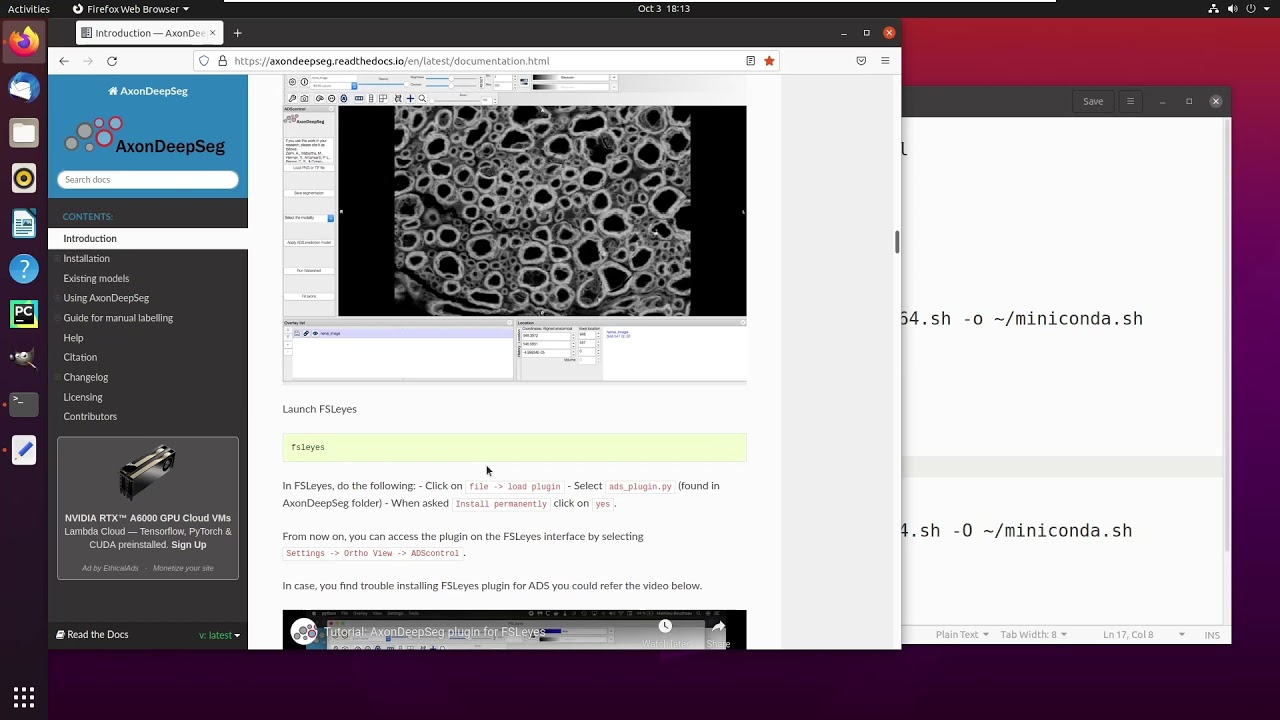 Tutorial: AxonDeepSeg installation