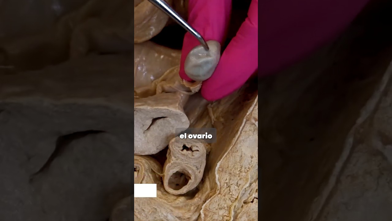 La gonorrea puede SUBIR