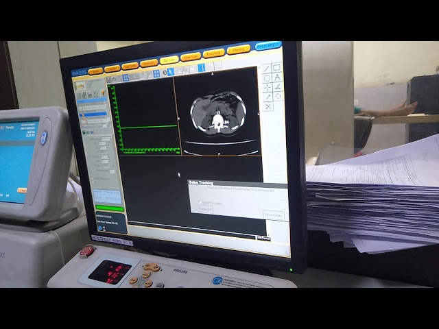 Philips Ct Scanner - Philips Ct Scan Machine Trader - Wholesaler ...