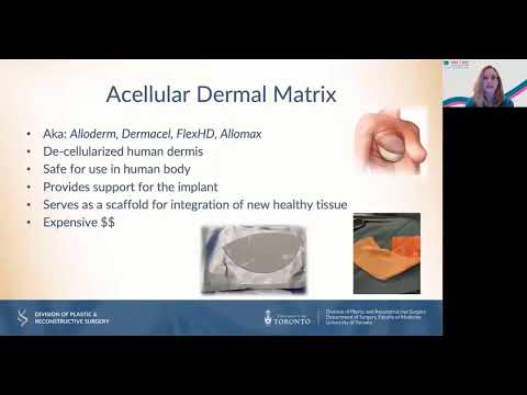 Breast Reconstruction with Implants by Dr. Mary Helen Mahoney