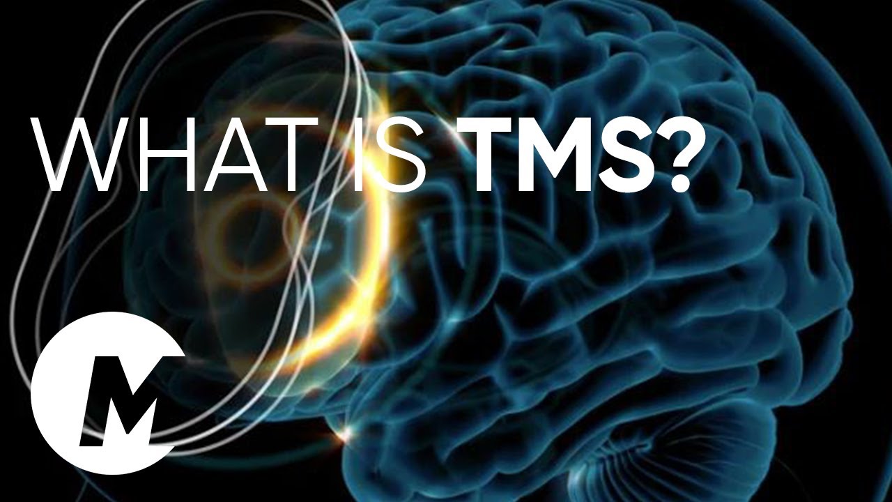 How does TMS Treatment Work I GIA Miami