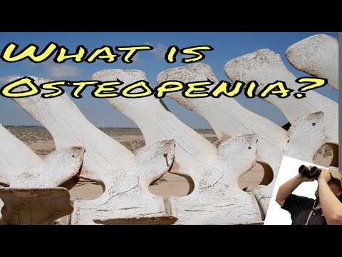 What is Osteopenia? A brief description of what osteopenia and osteoporosis are.