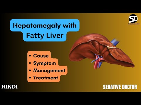 Hepatomegaly with Fatty Liver - Treatment and management | Hindi #fattyliver #fattylivertreatment