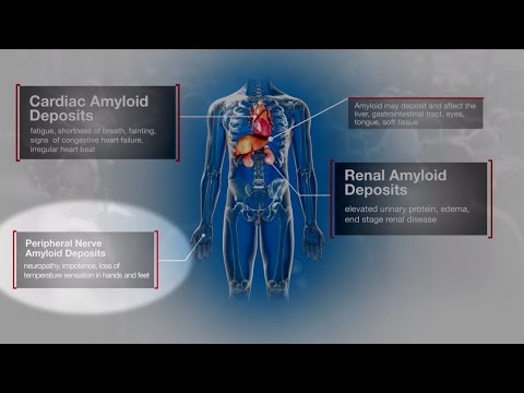 The Trouble with Diagnosing a Rare Disease