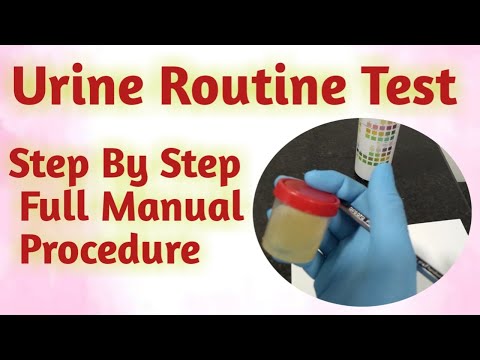 Urine Test Strip - Urine Test Kits Latest Price, Manufacturers & Suppliers