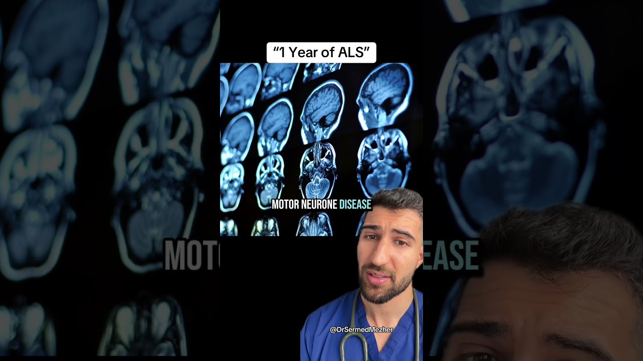 “1 Year of ALS” #changes