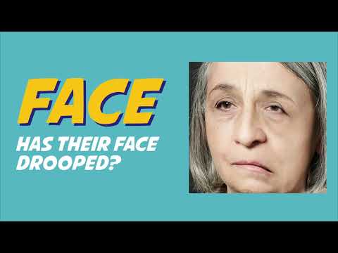 The F.A.S.T signs of stroke