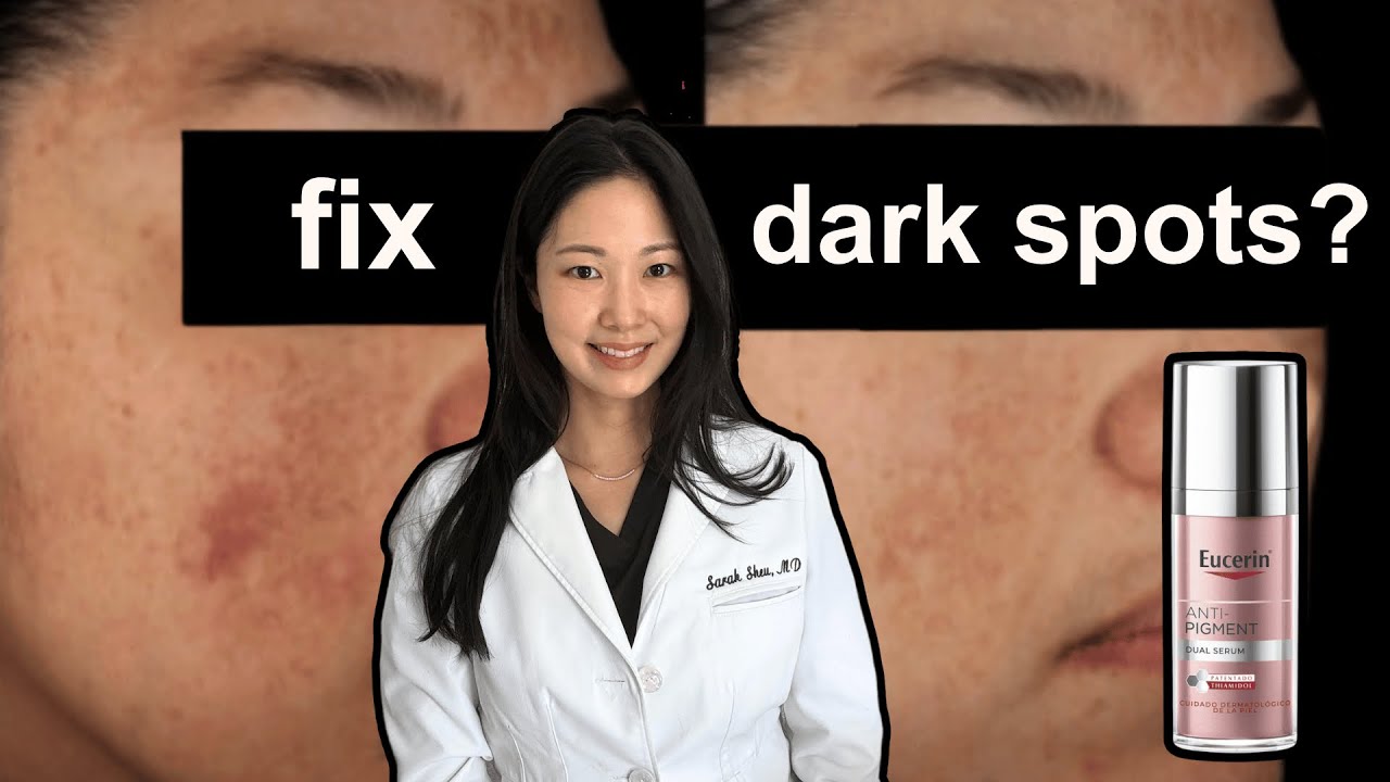 Dermatologist: Is Thiamidol Worth It or Overhyped?