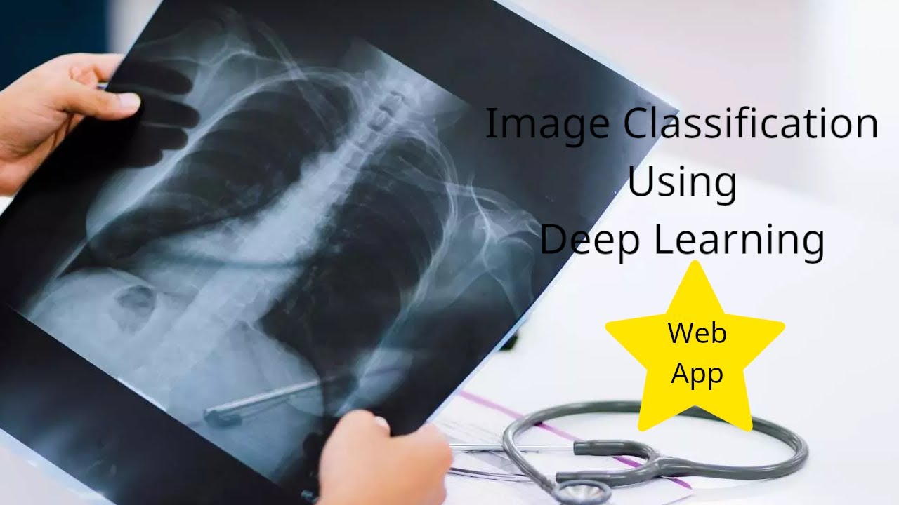 Image Classification Using Deep Learning (Chest X-Ray)