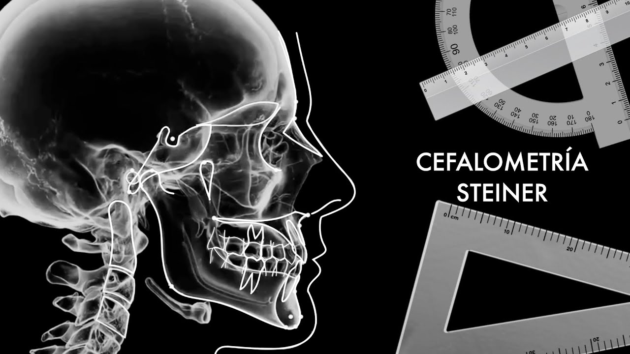 Cefalometría de Steiner