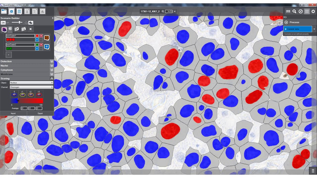 3DHISTECH - CellQuant