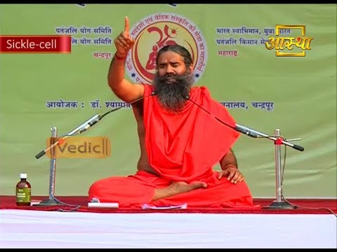 Ayurvedic Treatment for Sickle-Cell Disease | I Support Baba Ramdev