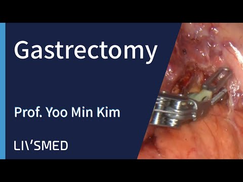 Gastrectomy - Prof. Yoo Min Kim