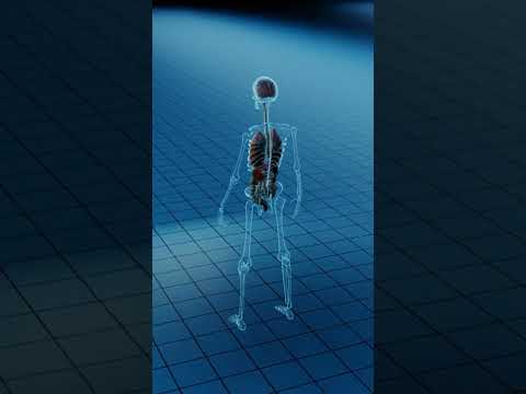 Stage 1 to Stage 4: What Liver Cirrhosis Really Looks Like