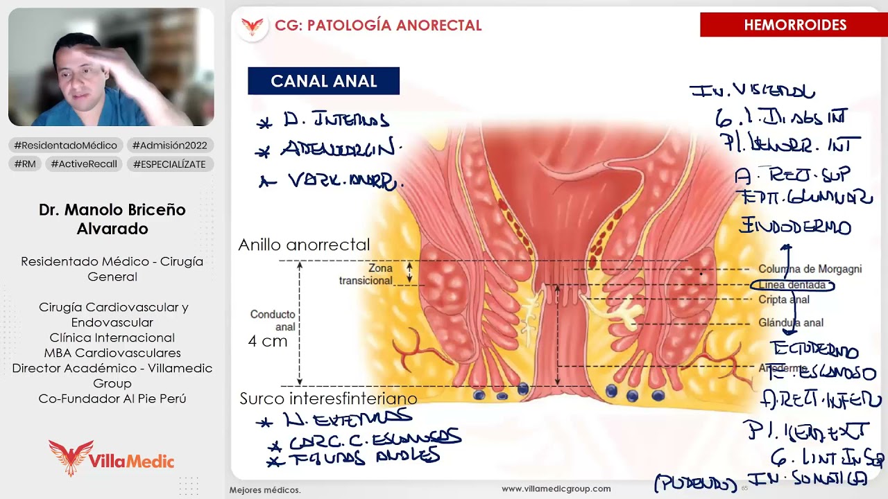 HEMORRHOIDS part 1