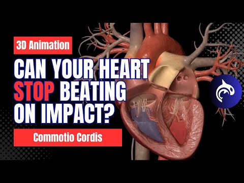Commotio Cordis - 3D Animation