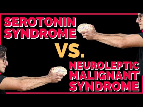 Serotonin Syndrome vs. Neuroleptic Malignant Syndrome