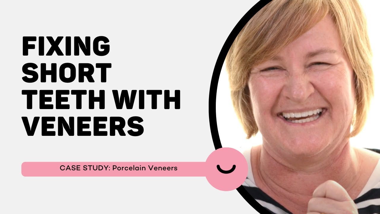 Fixing Short Teeth - 