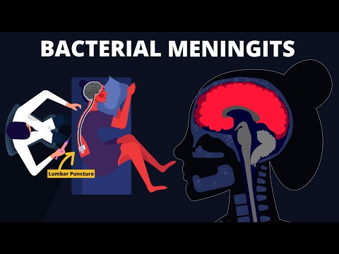 Bacterial Meningitis : Symptoms, Diagnosis, Treatments & Pathology