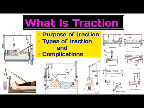 what is traction ? traction types| traction in orthopedics| Purpose of traction control|