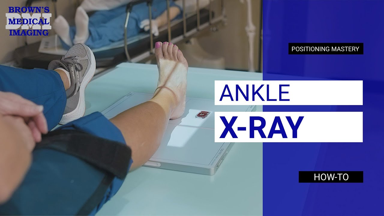 Ankle X-ray Positioning Mastery