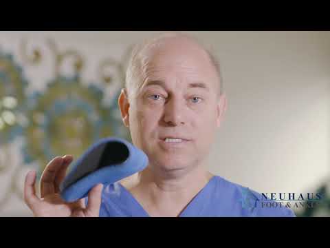 Replace cheap shoe inserts with these custom orthotics